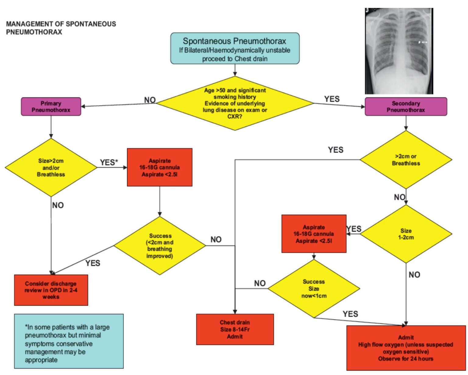 Pleural Diseases: Causes, Investigations, and Management | RSDC