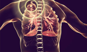 RSDC | Lung Function | Sleep Study